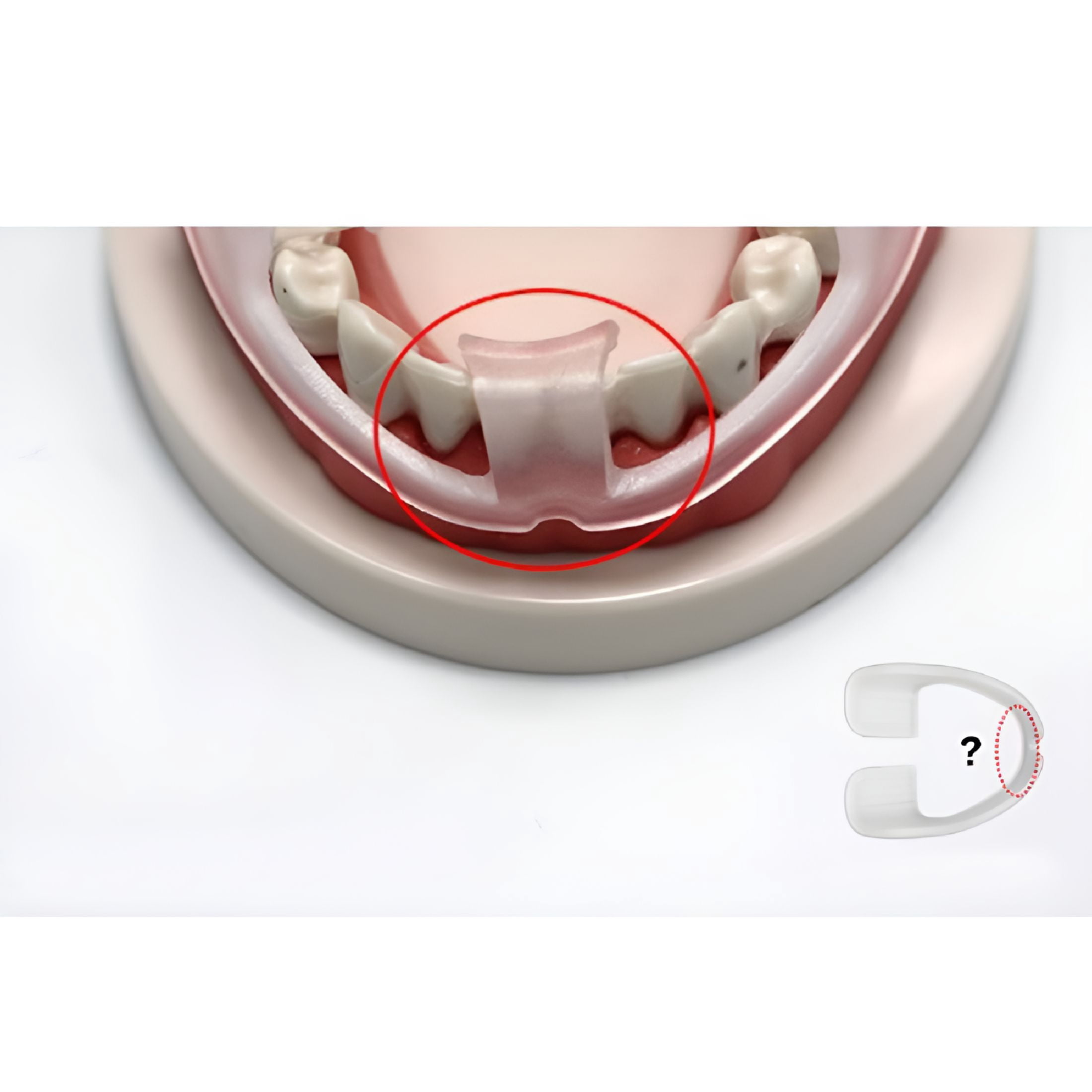 XIRQI Mouth Guard 3Pcs Dental Night Protector Dental Guard No More ...