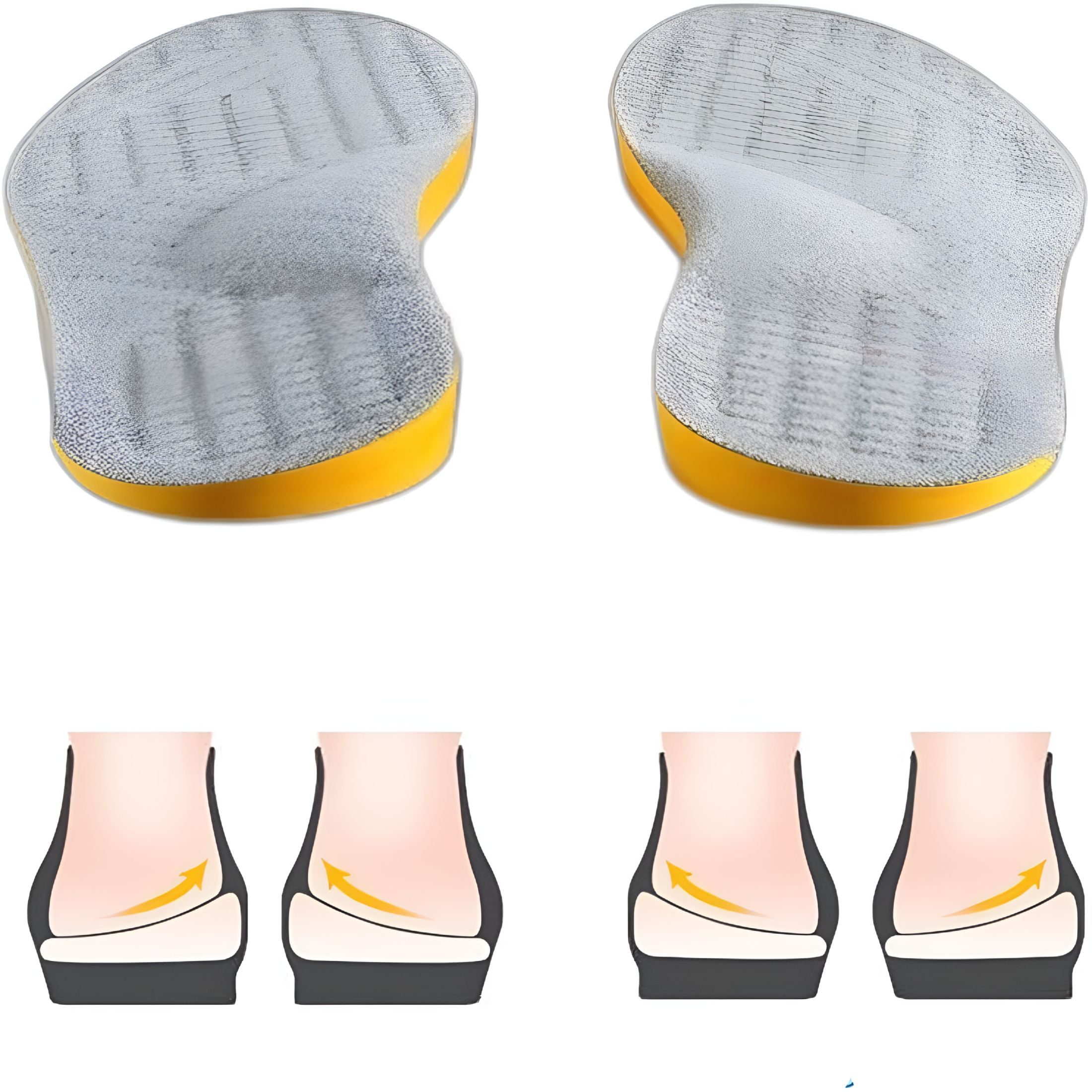 XIRQI Posture Correcting Orthotic Insoles 4 in 1 Gel Insoles Flat Feet ...