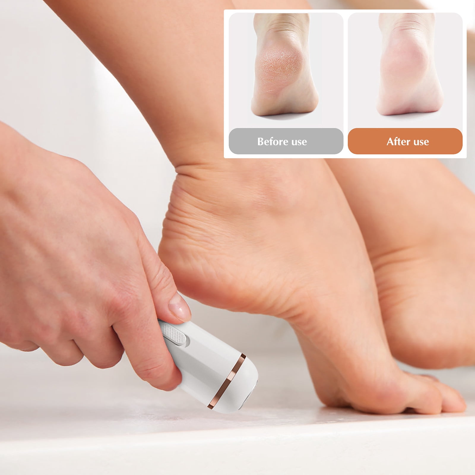 XMMSWDLA New Type Of Individual Skin Care, Dead Skin Removal, Foot ...