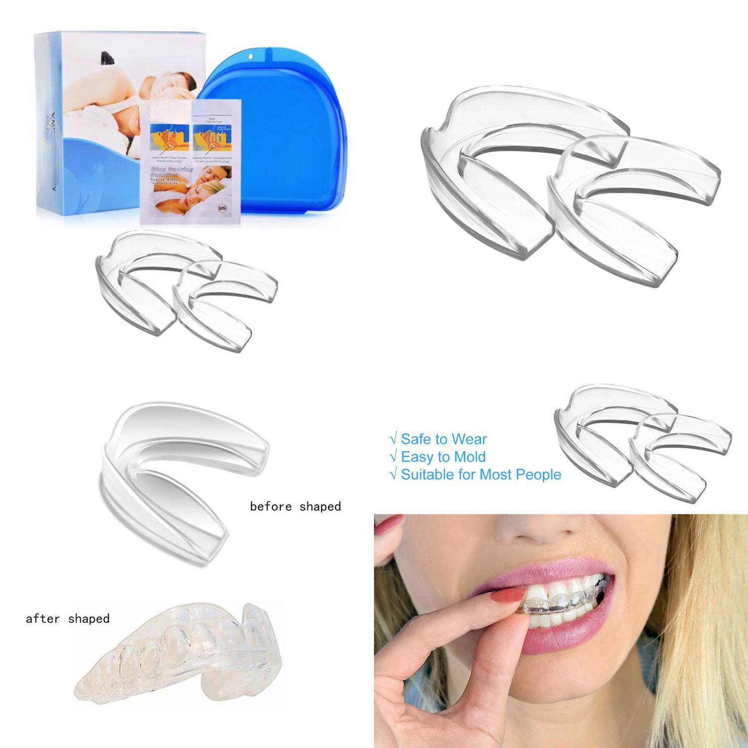 XOCHNGH Convenient and Comfortable Moldable Anti-Snoring Night Guards ...