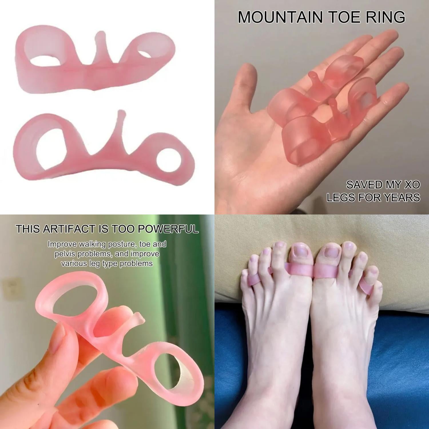 XOCHNGH Gentle and Effective 2pcs Toe Gel Corrective O-Legged Valgus ...