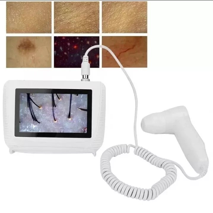 XYZDreams LCD Digital Skin Diagnosis Beauty Devices Digital-Dermoscopy ...
