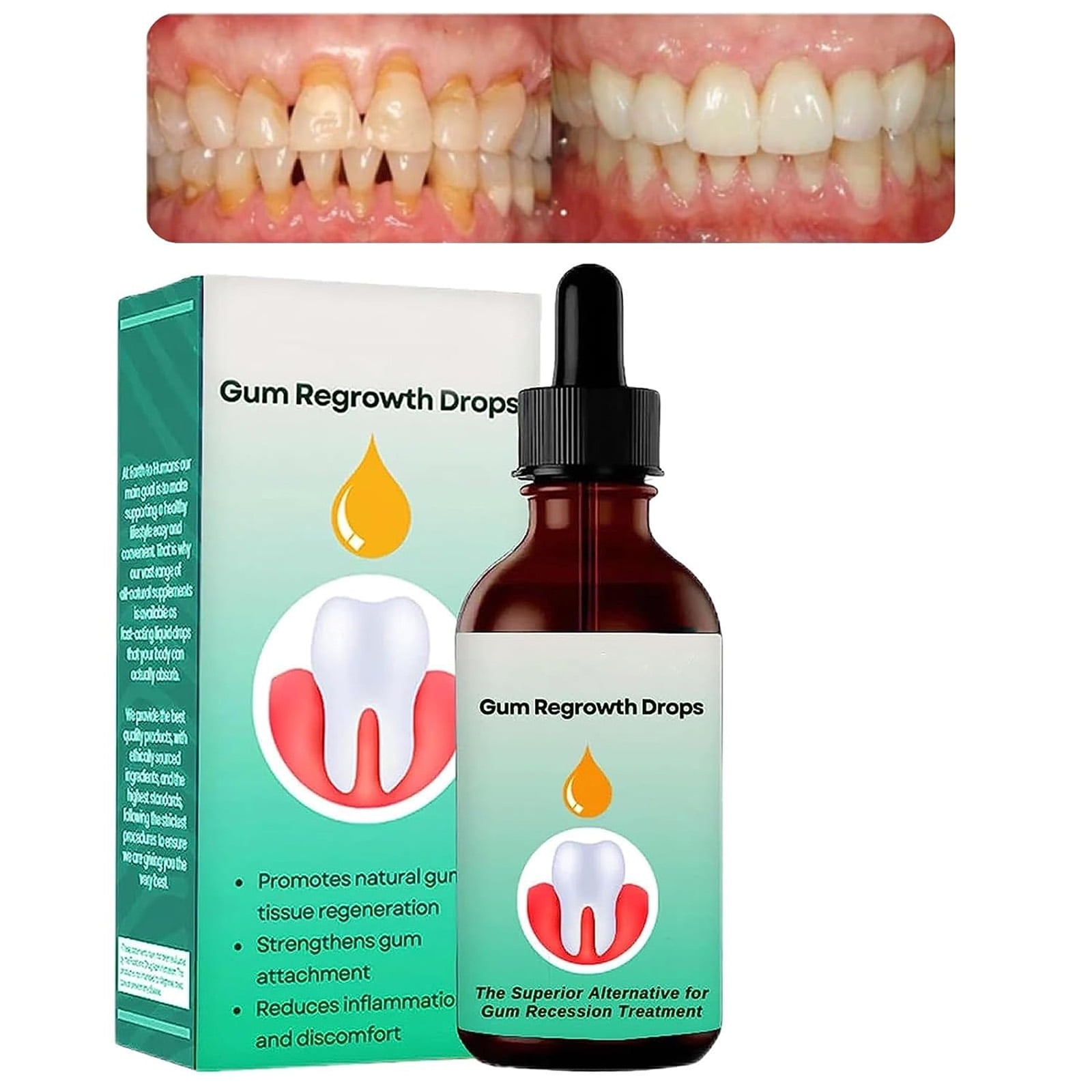 Xerdsx DentiZen Gum Regrowth Drops, Gum Treatment for Receding Gums ...