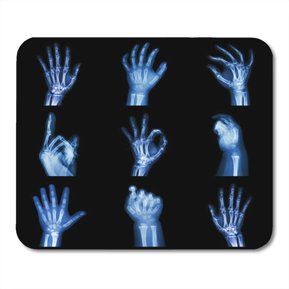 Conbicy Non Slip Rubber Base Xray Collection Mouse Pad - Walmart.com