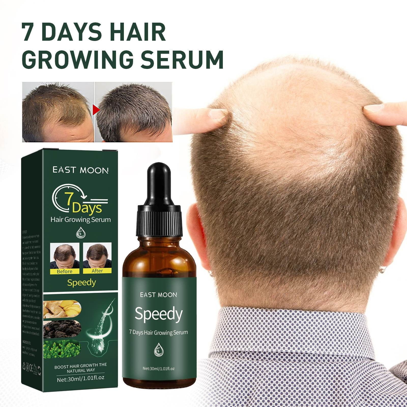 YFGEFTR Deals 7Days Hair Growing Serum, Anti-detachment,Hair ...