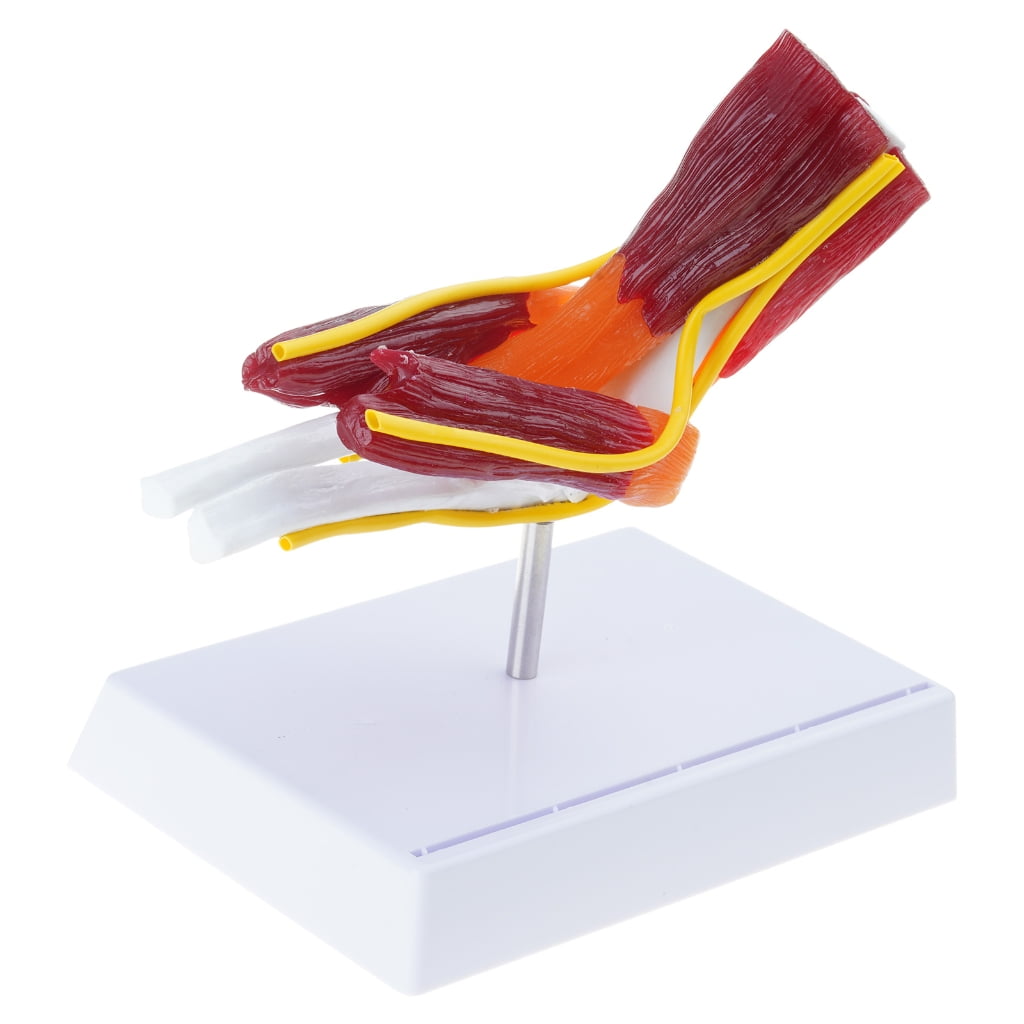 YIGSECU Realistic Elbow Joint Muscles With Muscles Nerves for Clinical ...