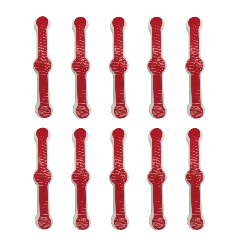 YIGSECU Set of 10 Mesh Window Screen Fixators Secure & Convenient ...