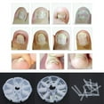 YLSHRF Ingrown Sticker,120pcs/box Ingrown Pedicure Toenail ...