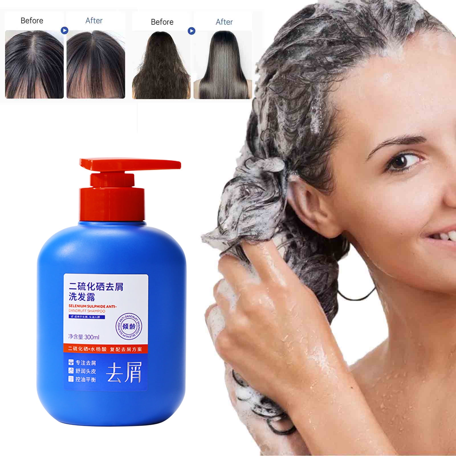 YMUQEIGH Clearance 300ml Selenium Disulfide Suntan And Dandruff ...