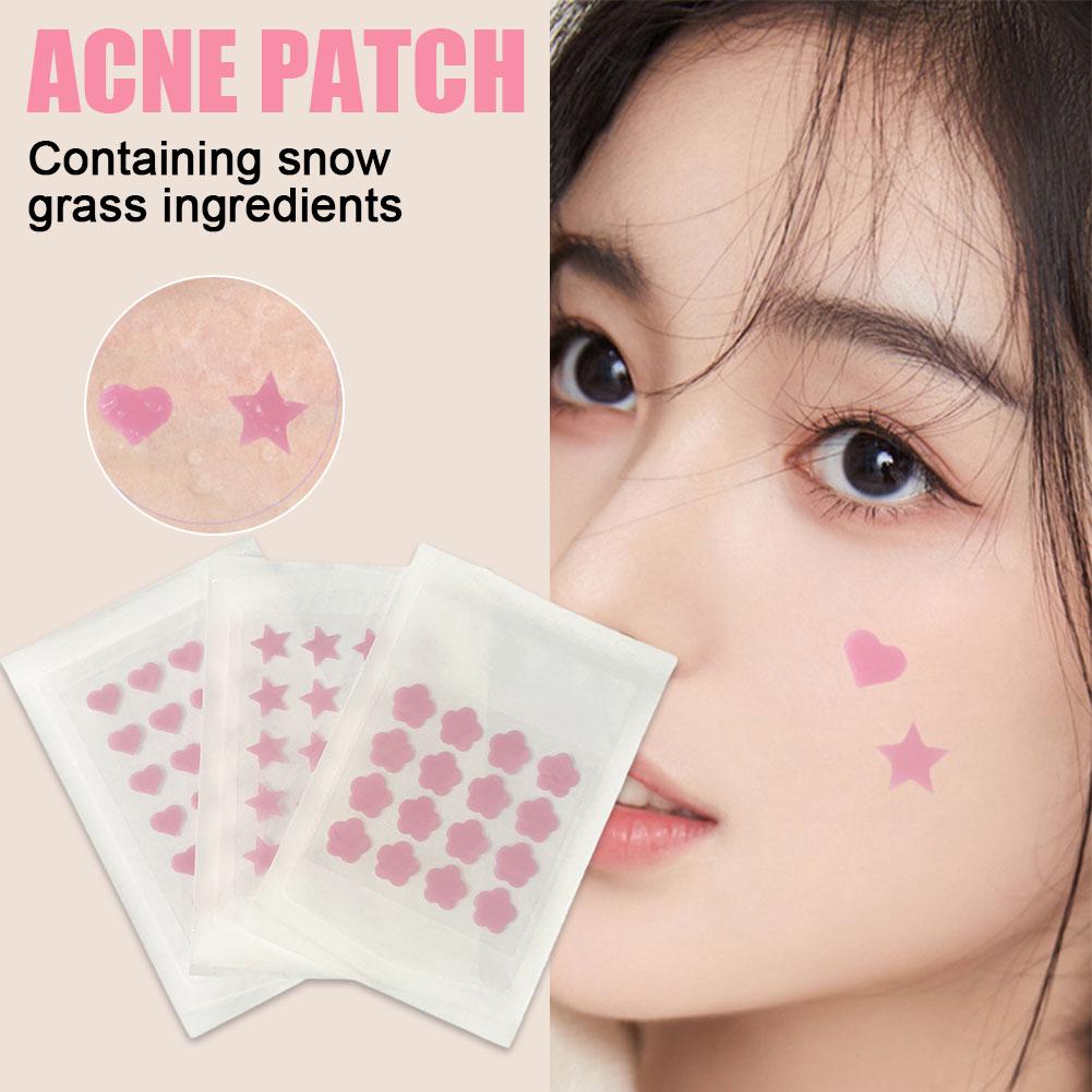 YUEYAN Acne Patch Tag Hydrocolloid Pimple Zit Spot Acne Patch Plaster ...