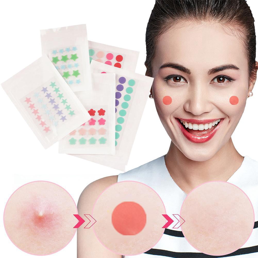 YUEYAN Invisible Acne Removal Pimple Patch Beauty Acne Tools Pimple ...