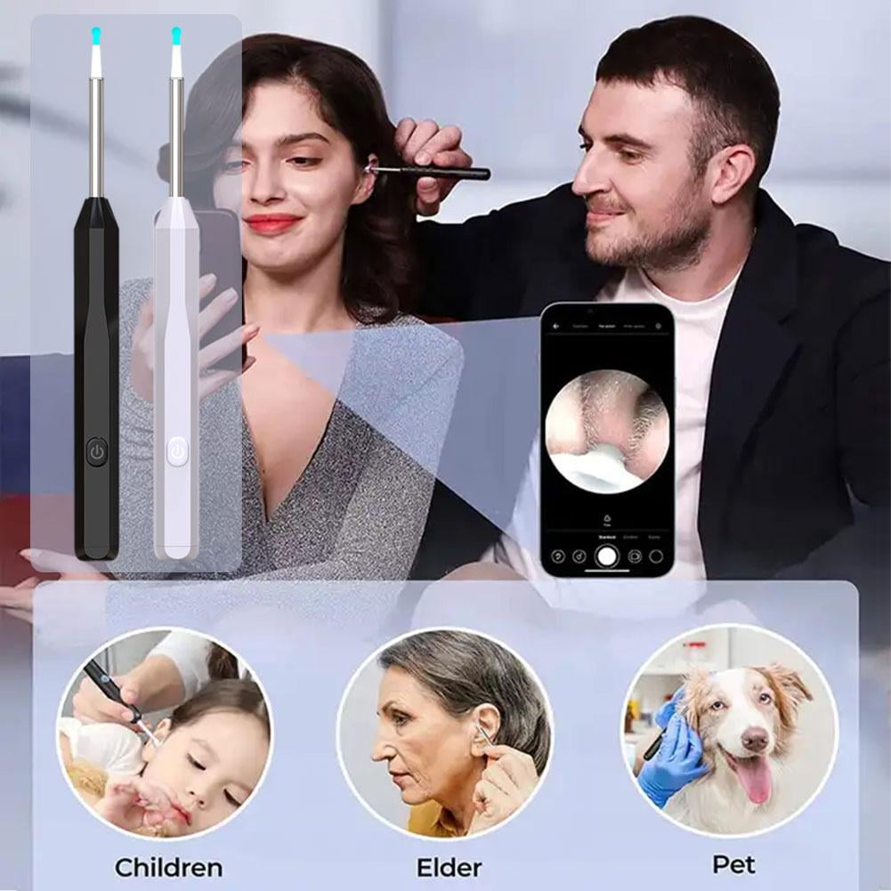 YUEYAN Smart Ear Wax Removal Cleaner Wireless Visual Endoscope Otoscope ...