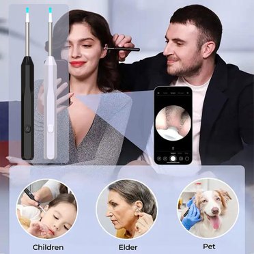 Bebird Wireless Ear Wax Cleaner Otoscope System with 30x Zoom for ...