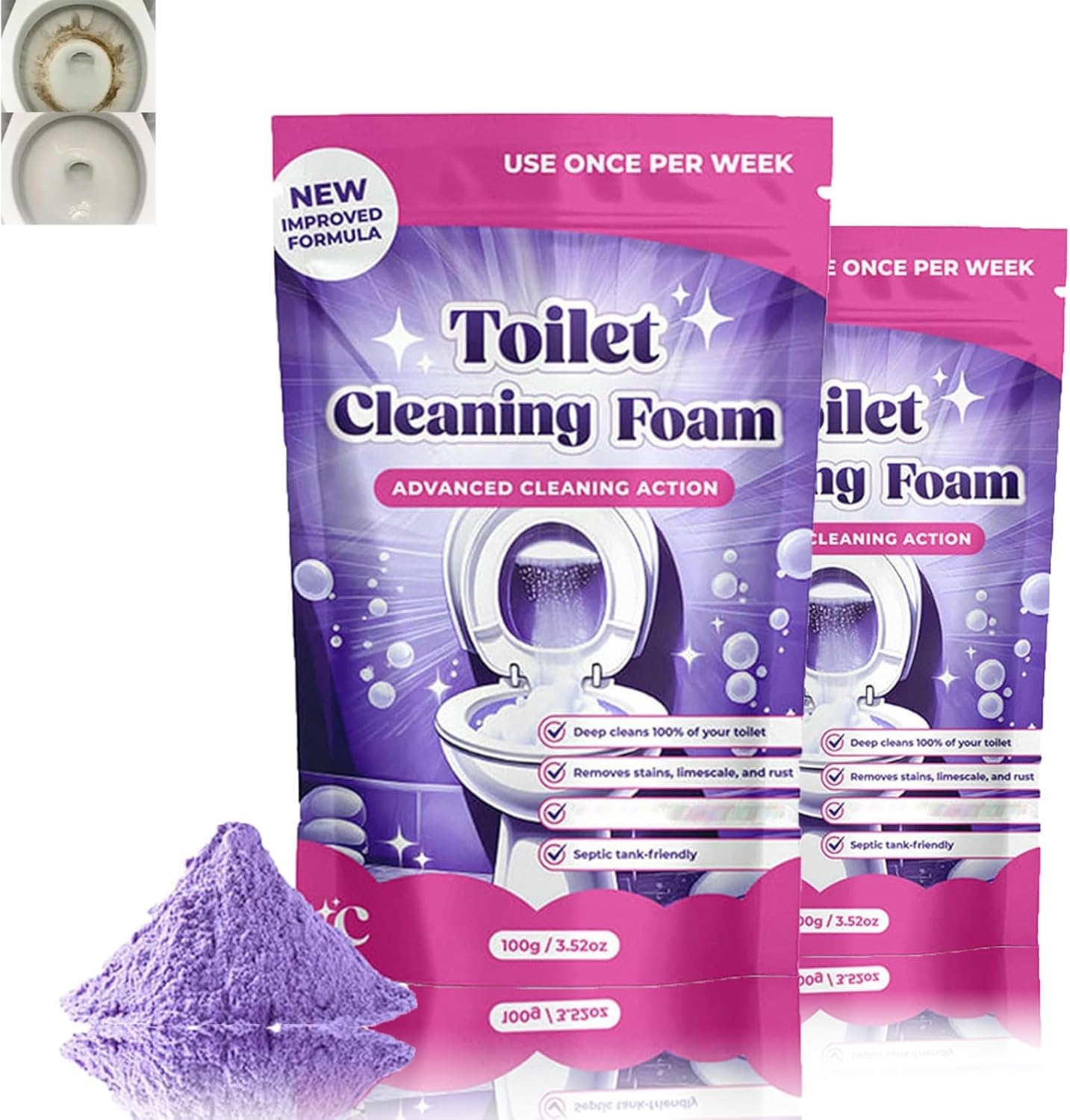 YYK Toilet Cleaner,Toilet Cleaner, Insta-Action Foam For Radiantly ...