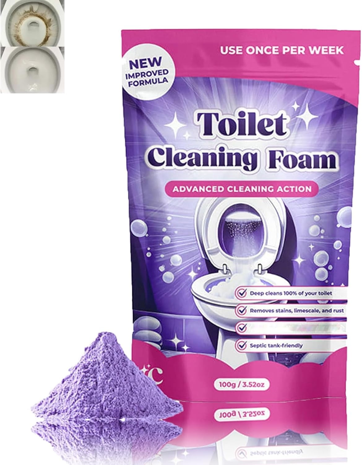 YYK Toilet Cleaner,Toilet Cleaner, Insta-Action Foam For Radiantly ...