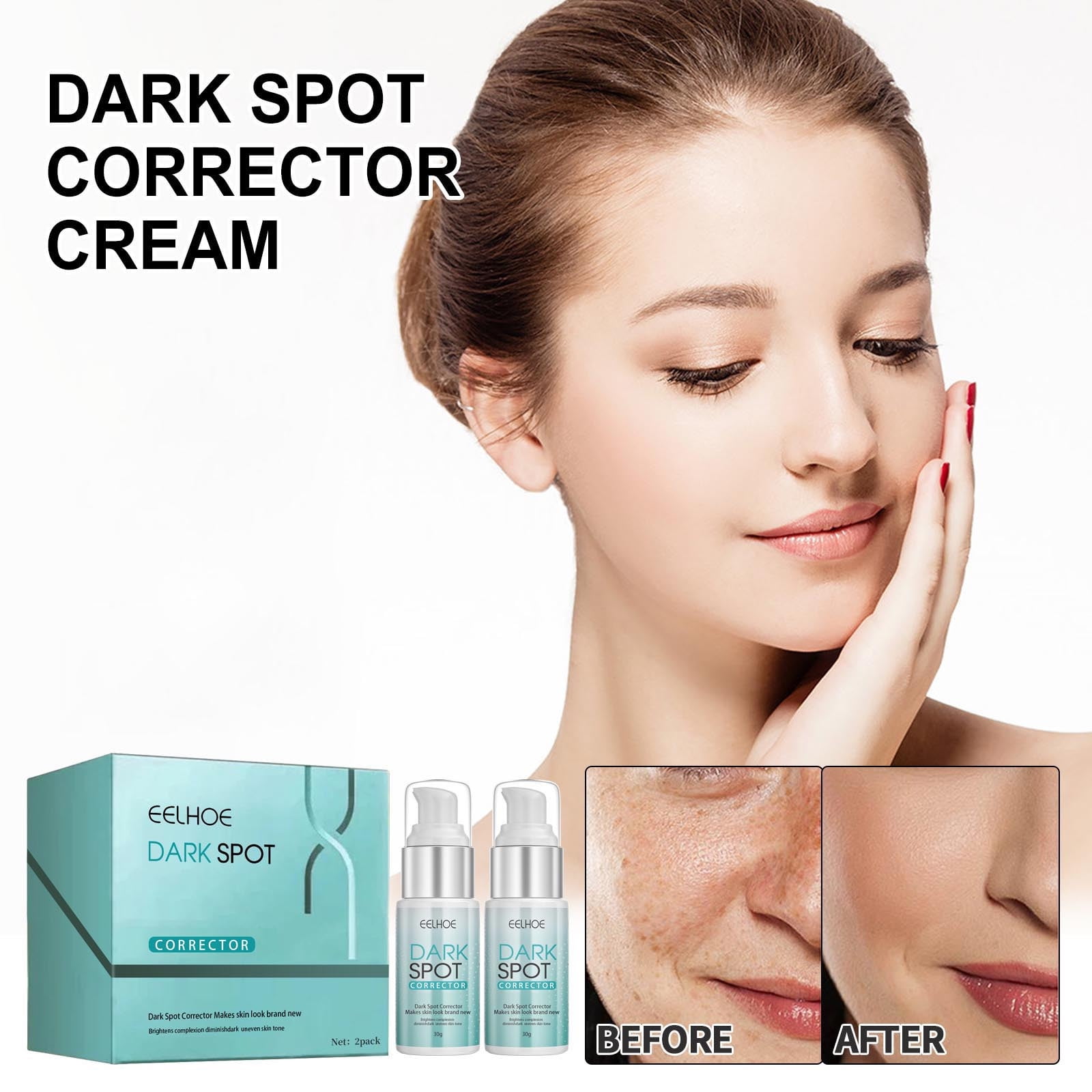 Yforlp Cream Suitable For Face And Body Age Spots And Freckles Dark S ...