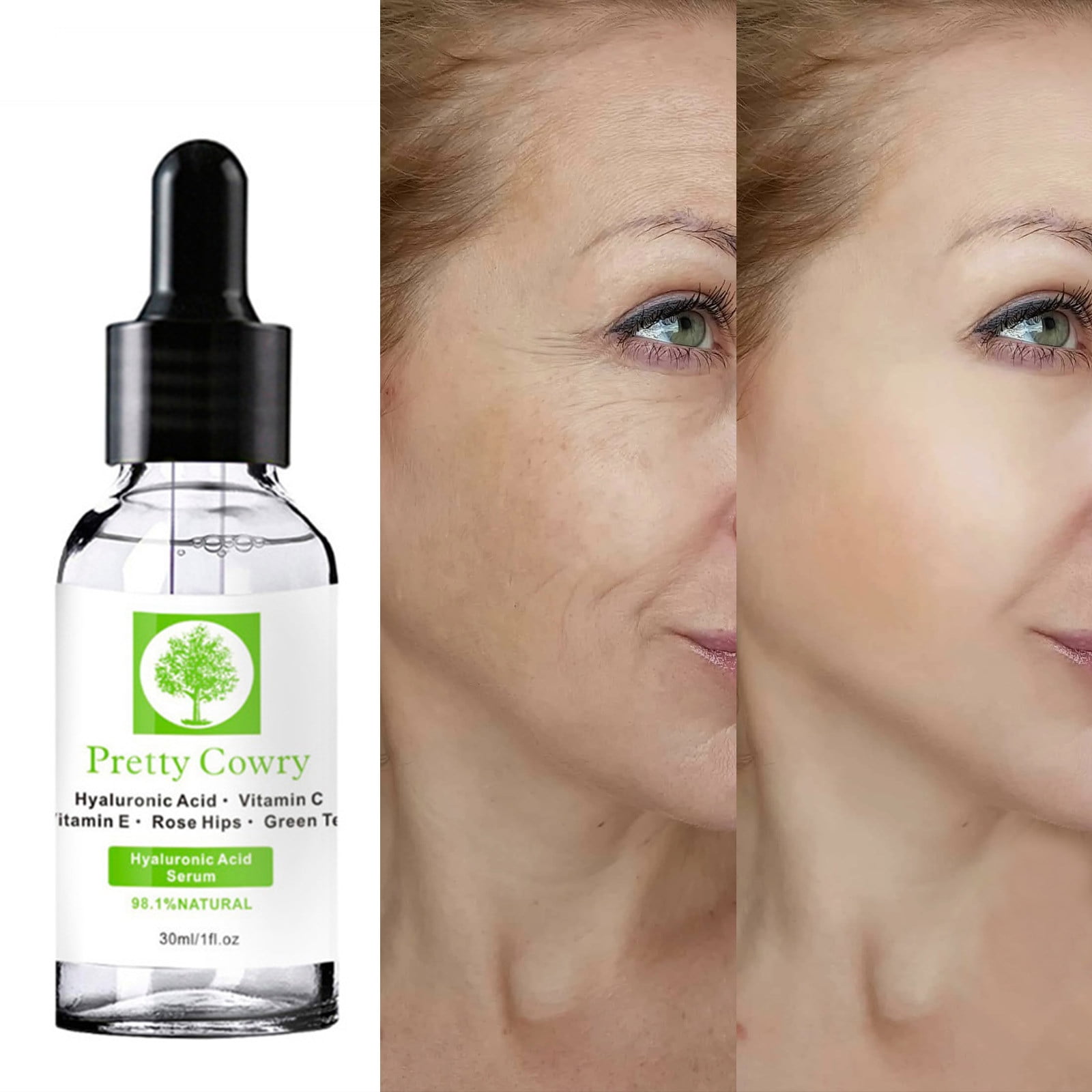 Yforlp VitaminC Serum For Face Topical Facial Serum With Hyaluronic ...