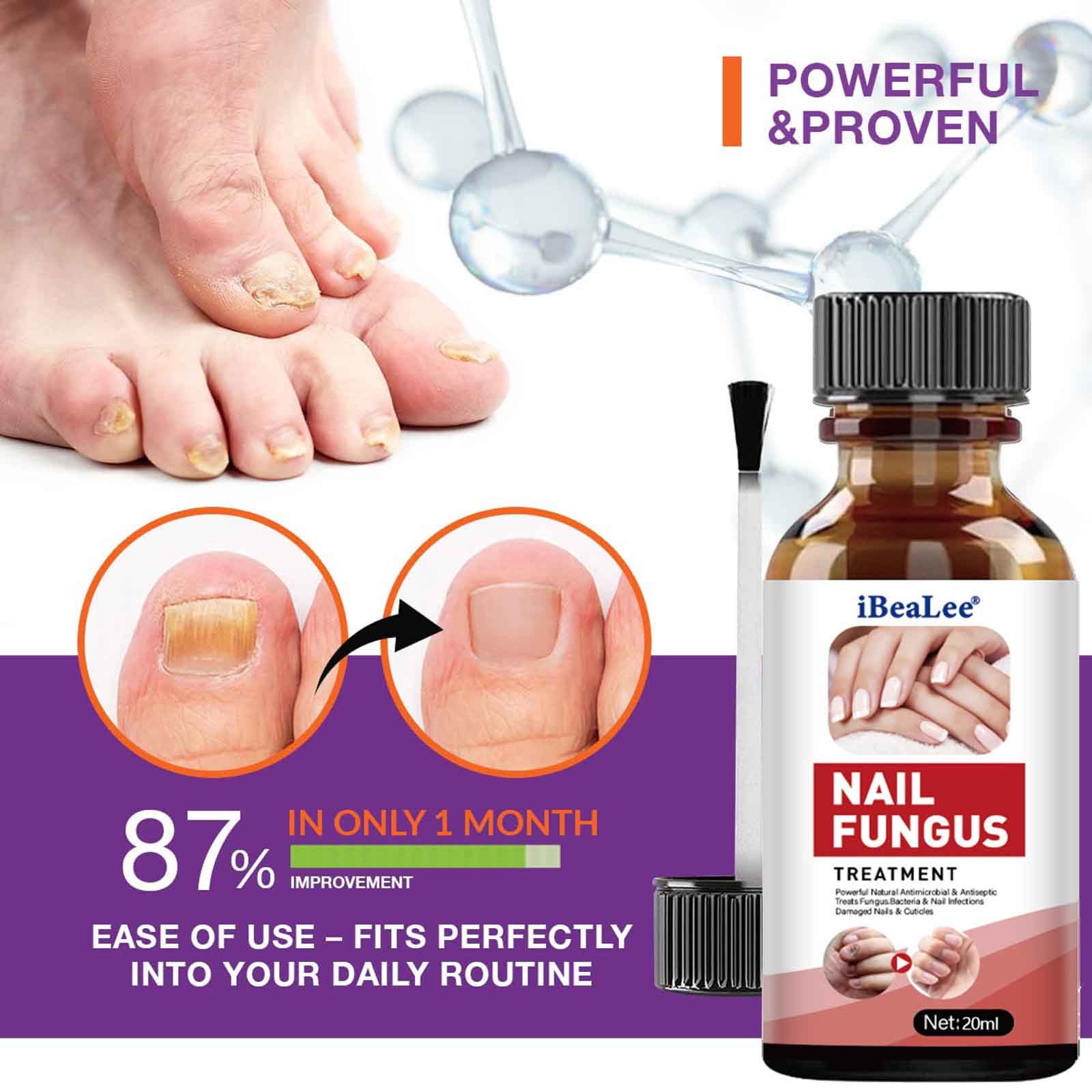 YiFudd Antibacteria Liquid Of Ash Nail Herbal Ash Nail Care Liquid Ash ...