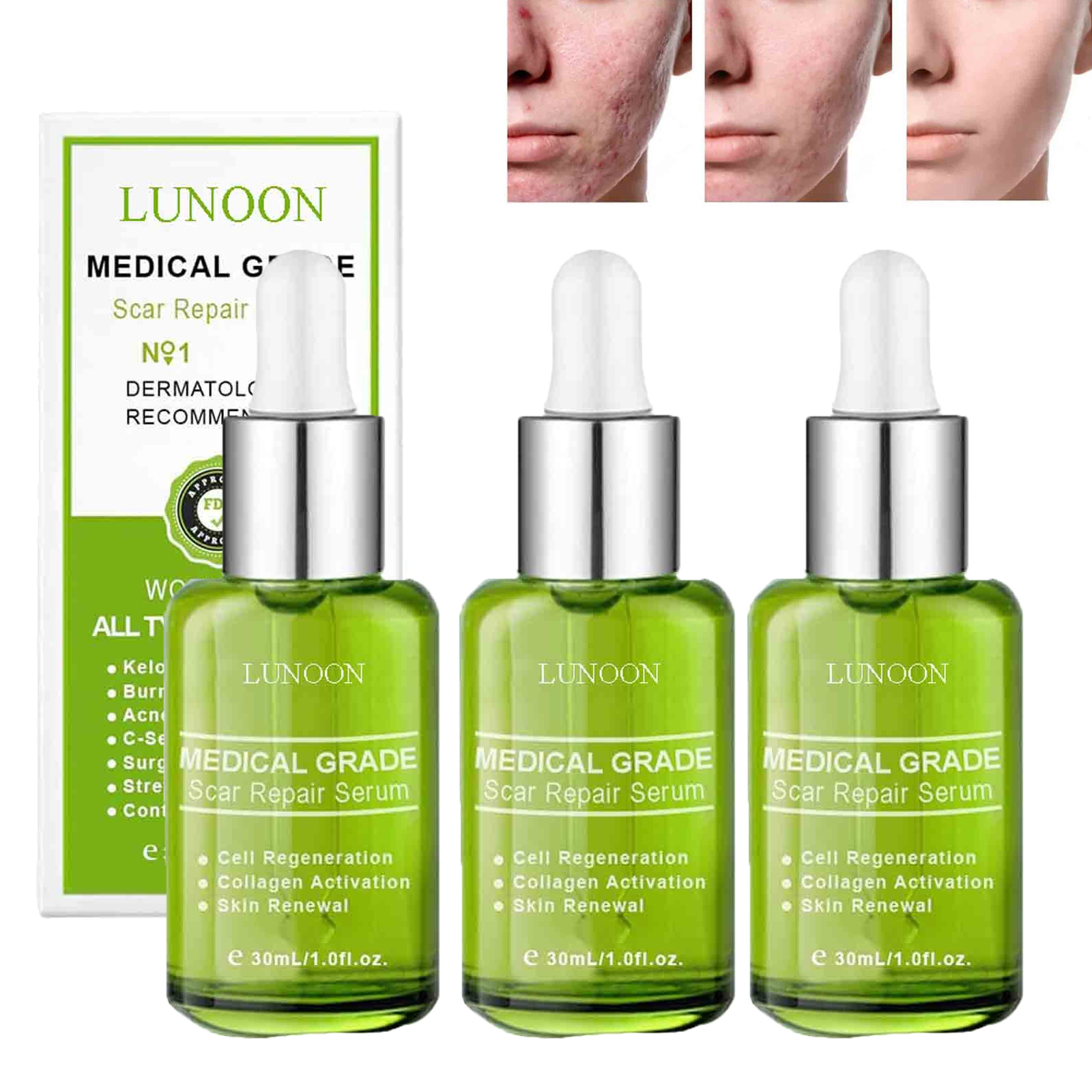 YiFudd Goopgen Advanced Scar Repair Serum, Goopgen Grade Scar Repair ...