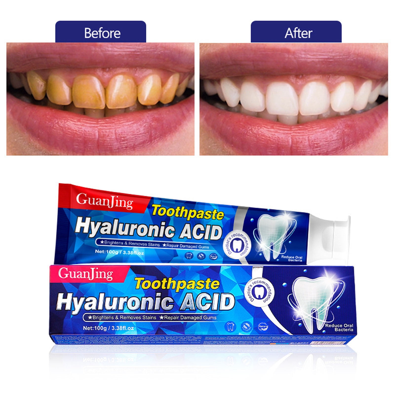 YiFudd Hyaluronic Acid Toothpaste Tooth Whitening Booster Remove Tooth ...