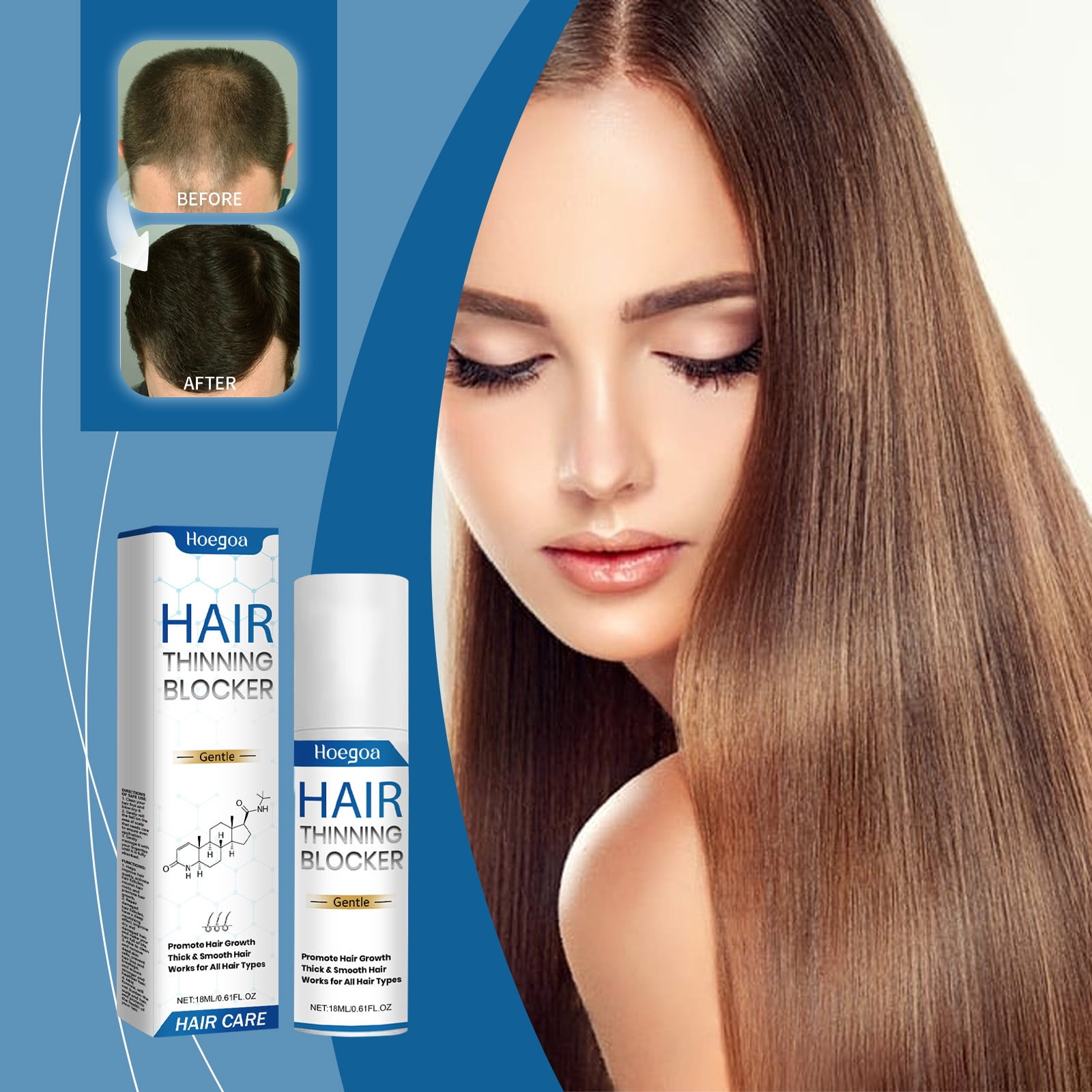 Yika Gentie Hair thinning Blocker for Men,Gentie Hair Growth Roller ...