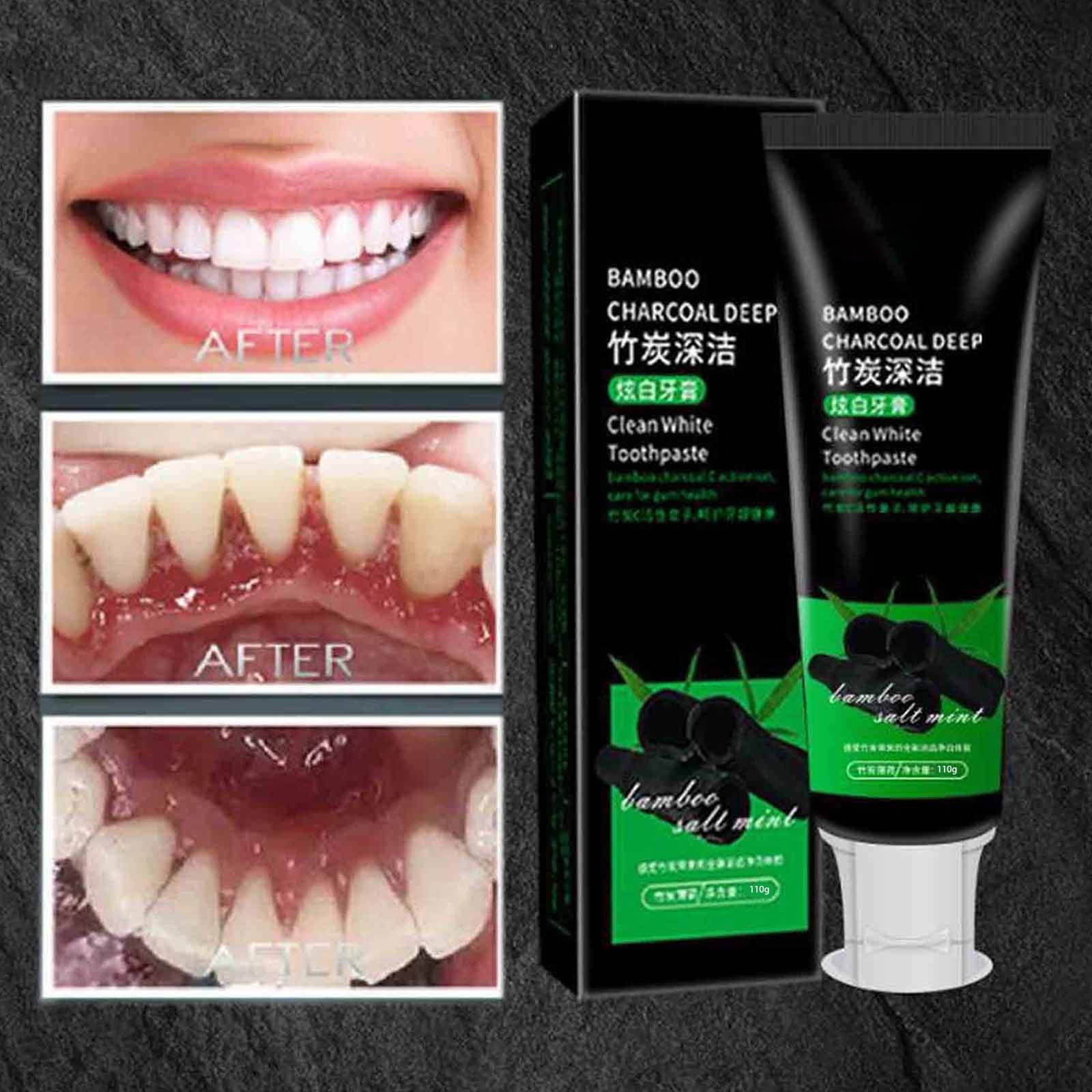 YingTaiLi Charcoal Whitening Toothpaste, Whitening Toothpaste, Charcoal ...