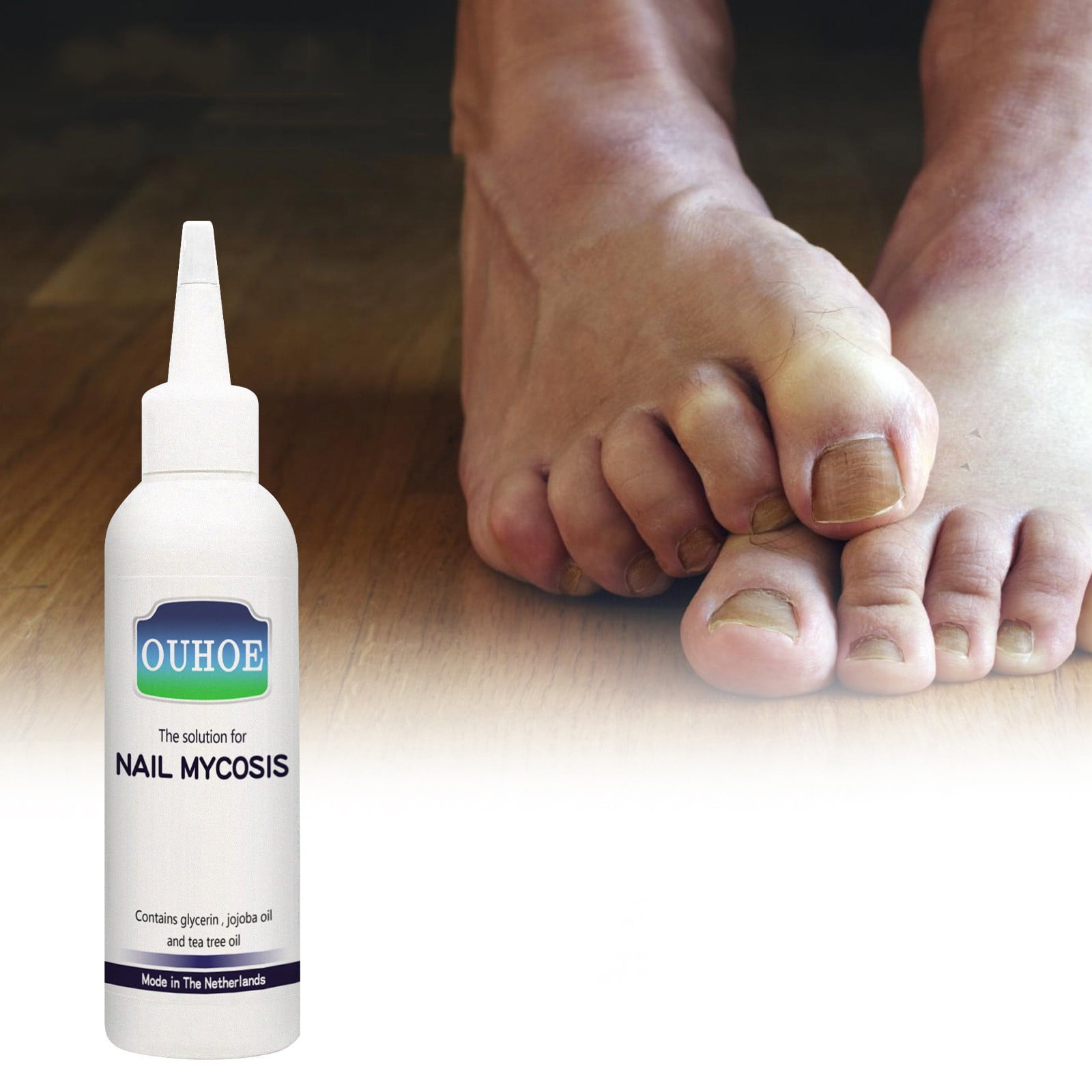 Yiqing Reduced Nail Care Skin Foot Jock Itch Extra Strength Ringworm ... Yiqing Reduced Nail Care Skin Foot Jock Itch Extra Strength Ringworm ...