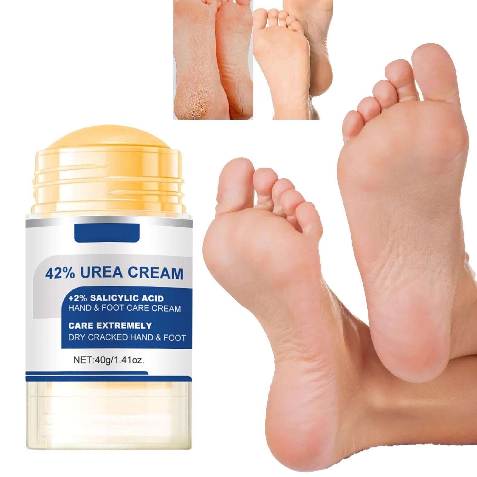 Yiqing Reduced Personal Skin Care 42% Plus 2% Salicylic Foot ... Yiqing Reduced Personal Skin Care 42% Plus 2% Salicylic Foot ...