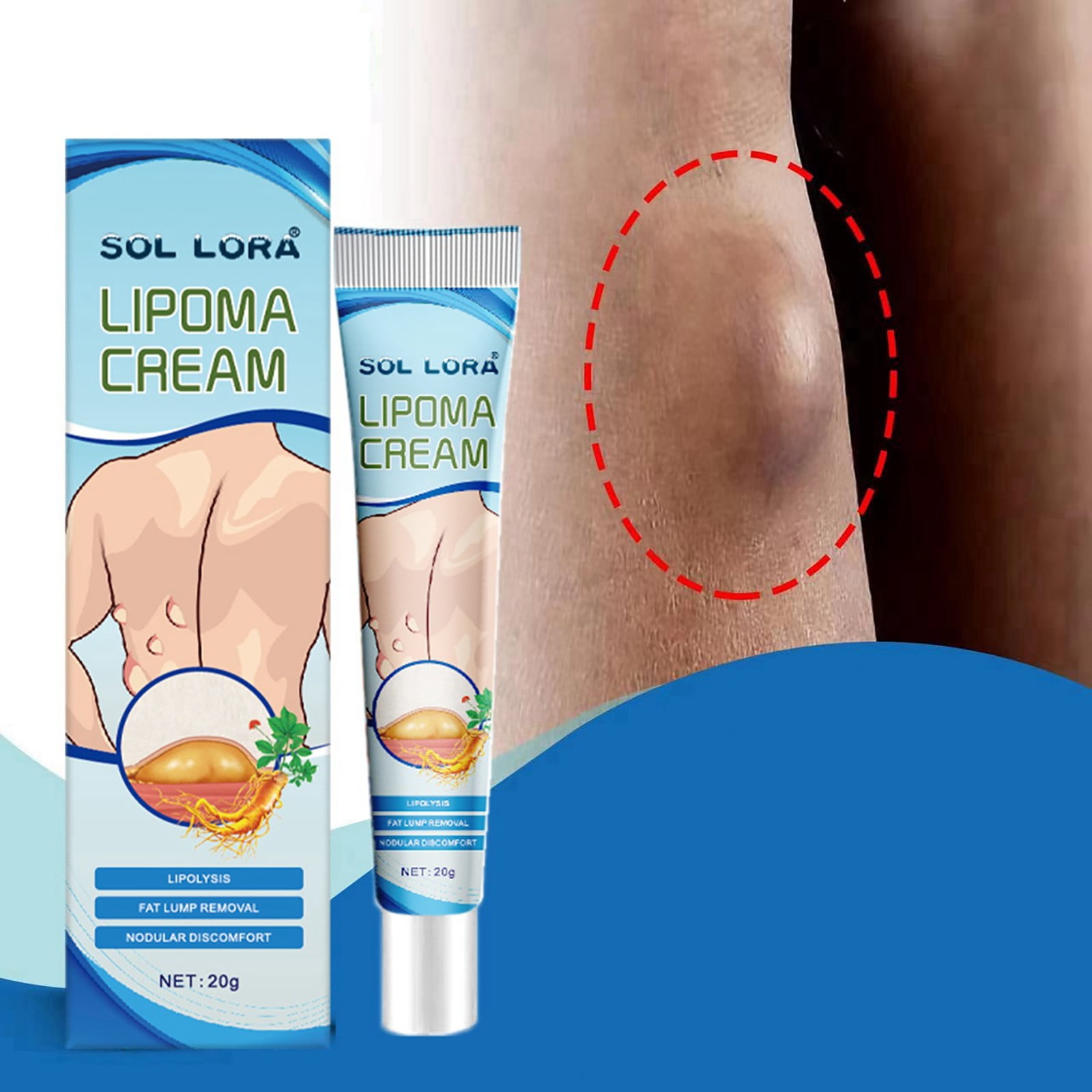 Yiqing Reduced Personal Skin Care No Lump Lipoma Removal Relieving ... Yiqing Reduced Personal Skin Care No Lump Lipoma Removal Relieving ...