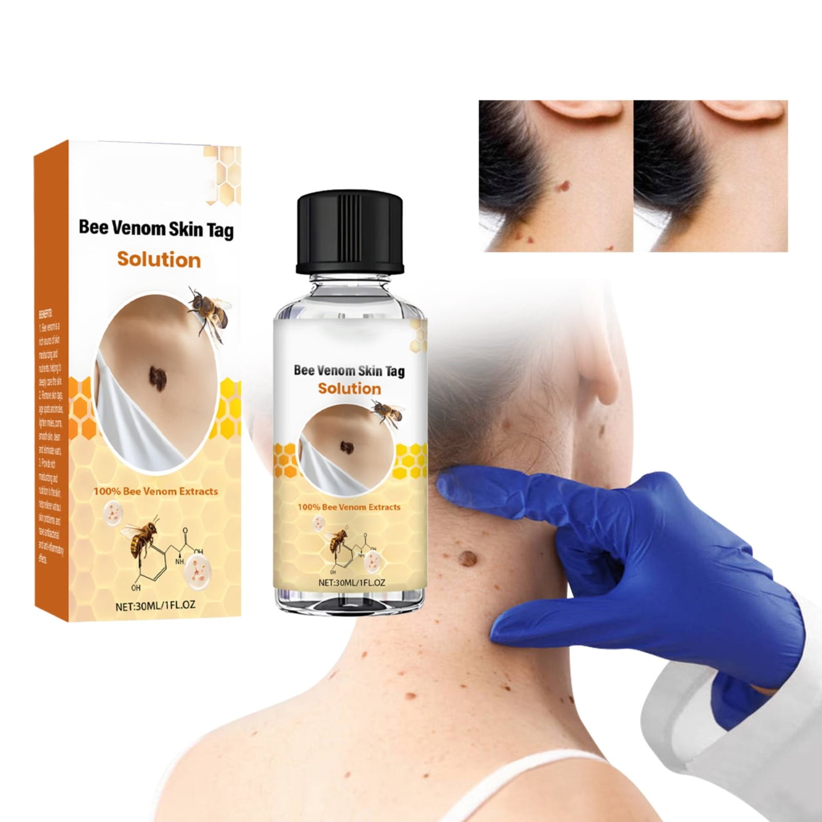 Yiqing Reduced Personal Skin Care Tag Recede 2024 New Tag Recede Spray ... Yiqing Reduced Personal Skin Care Tag Recede 2024 New Tag Recede Spray ...