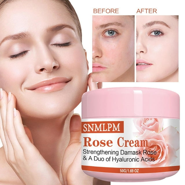 YoWeiPon Face Cream / Skin Care - Removal Ointment And Cream Mark And ...