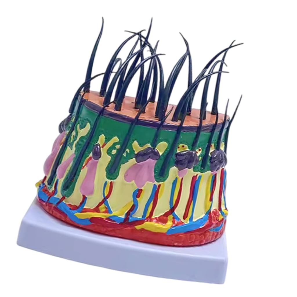 Yokua Human Scalp Model 50X Enlarged Scalp Structure Anatomical Model ...