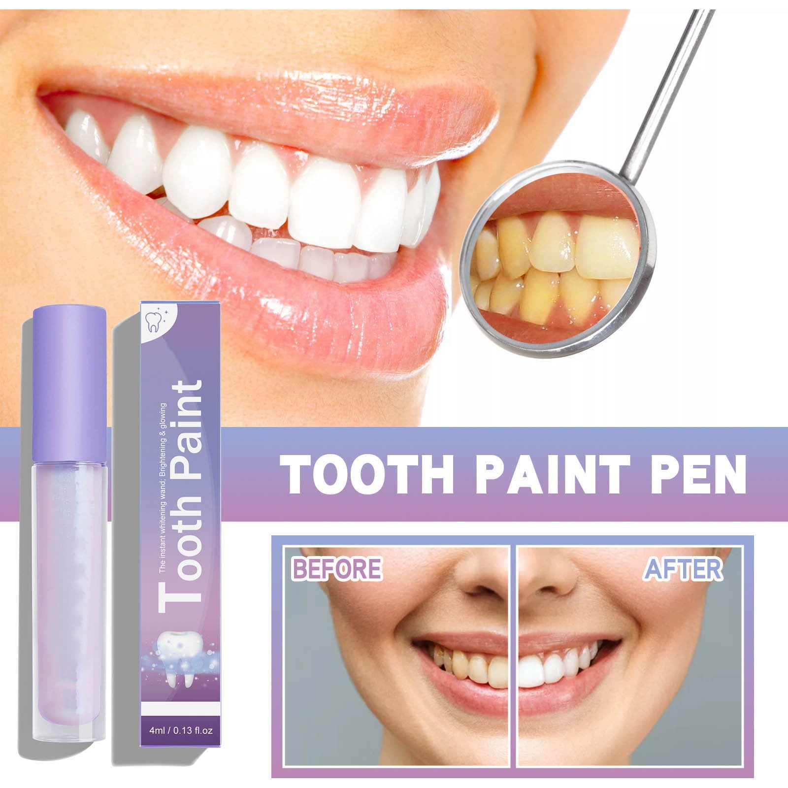Yolmart Tooth Gloss Tooth Gloss Whiter Teeth Teeth Pen Teeth Pen For ...