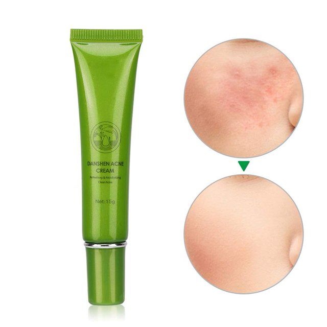 Yoluxingy Mabrem Removal Cream Blackhead Pimple Removal Moisturizing