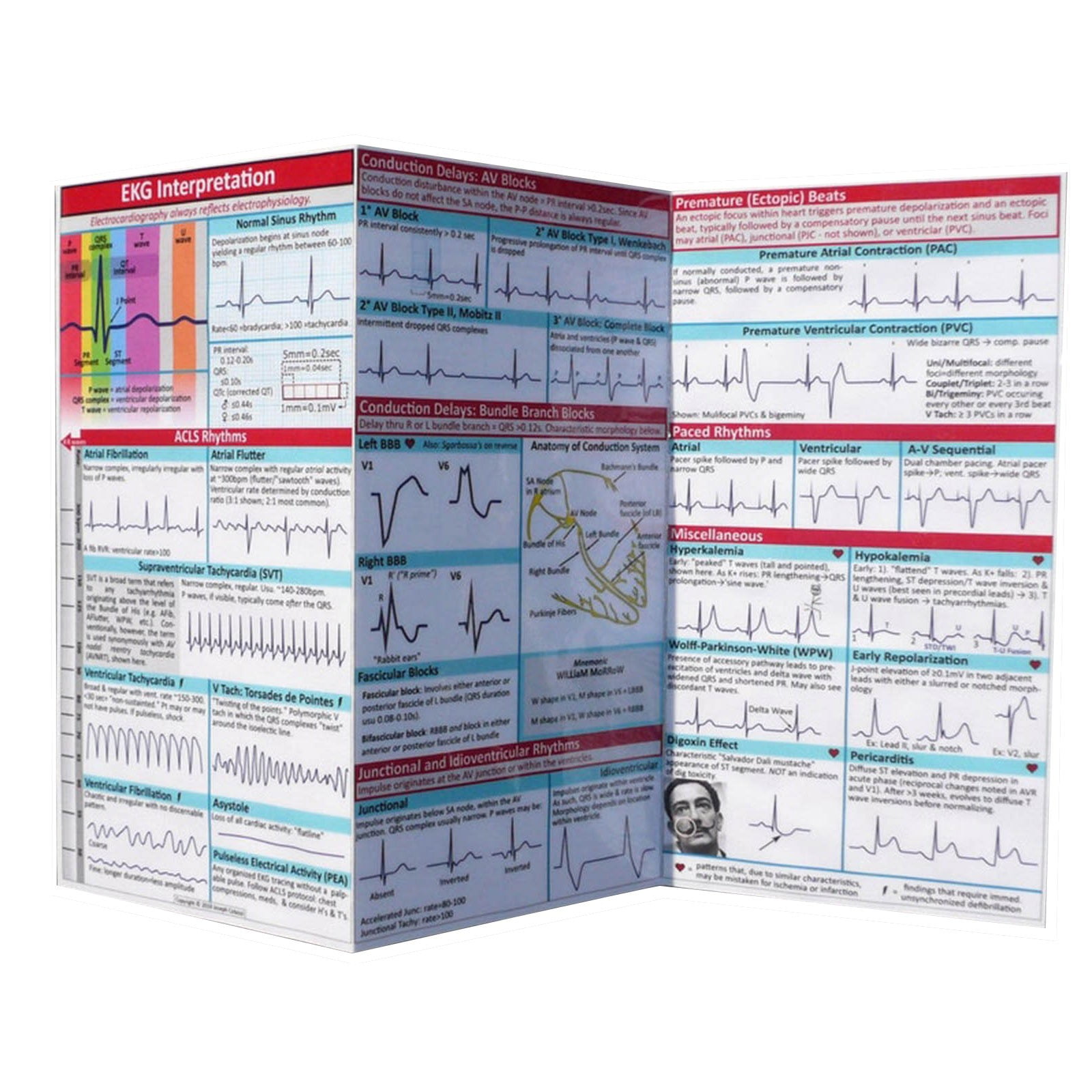 Yoncen EKG Pocket EKG Interpretation Double Tri Fold Pocket Reference ...
