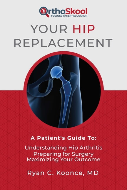 Your Hip Replacement: A Patient's Guide To: Understanding Hip Arthritis ...