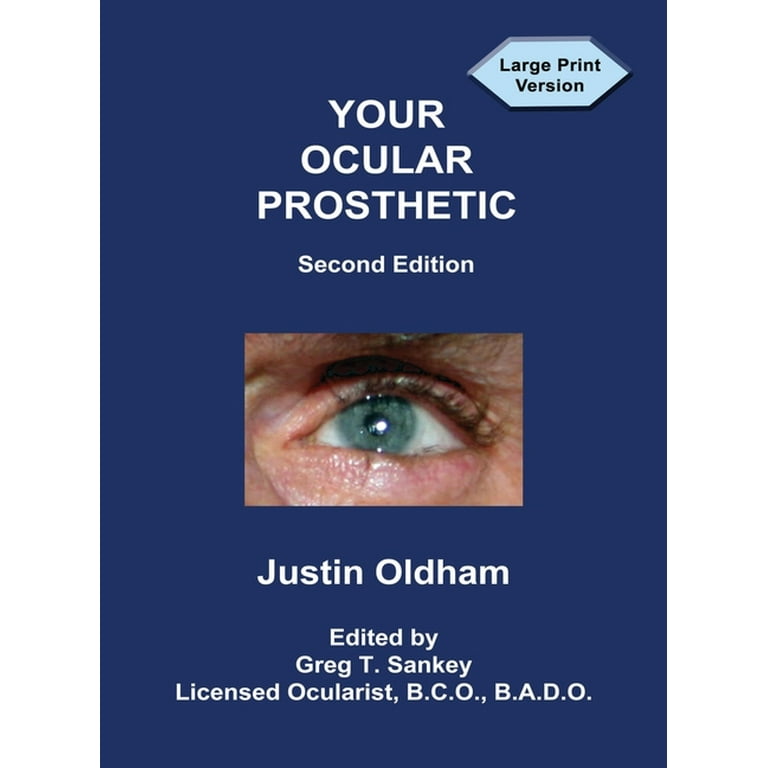 Ocular Prosthetic