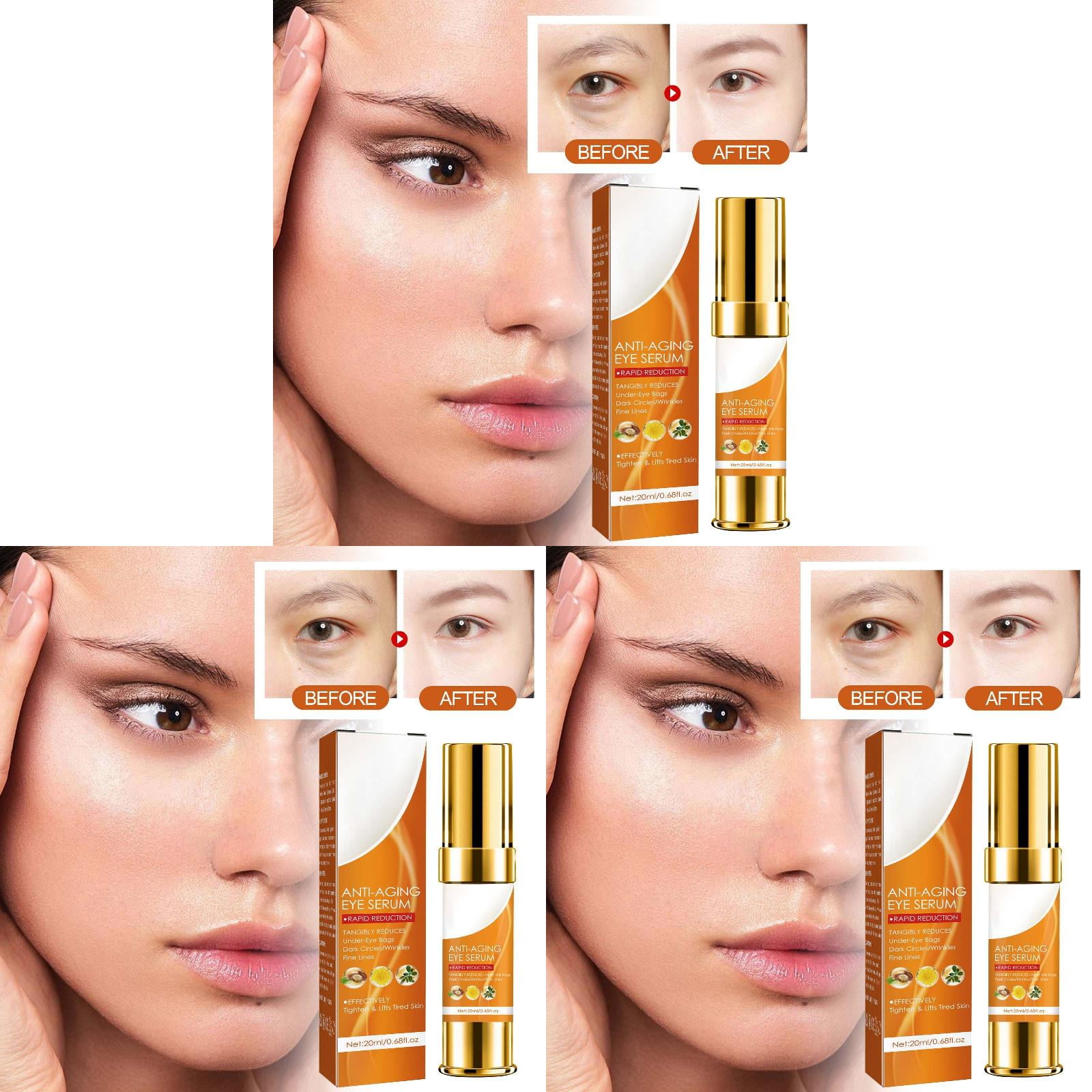 “Youth Preserving Eye Reduces Fine Lines Dark Circles Eye Bags And ...