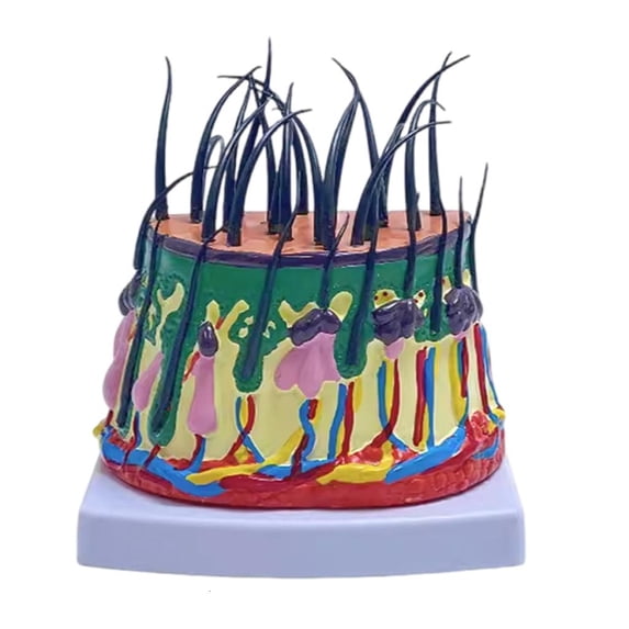 Ywmsfl 50X Enlarged Scalp Model Scalp Anatomical Model Teaching Tool ...