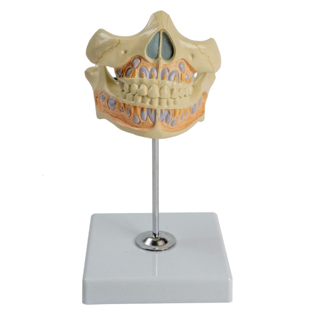 Ywmsfl Human Tooth Gingiva Anatomy Model for Scientific Research ...