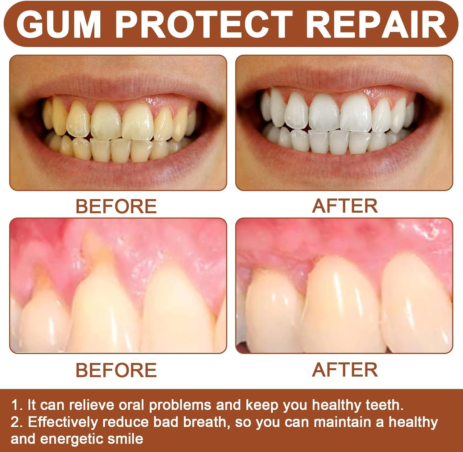 ZHAOJIN Pack Of 2 Gum Gel, Gum Recovery Drops, Gum Repair Drops, 30 Ml ...