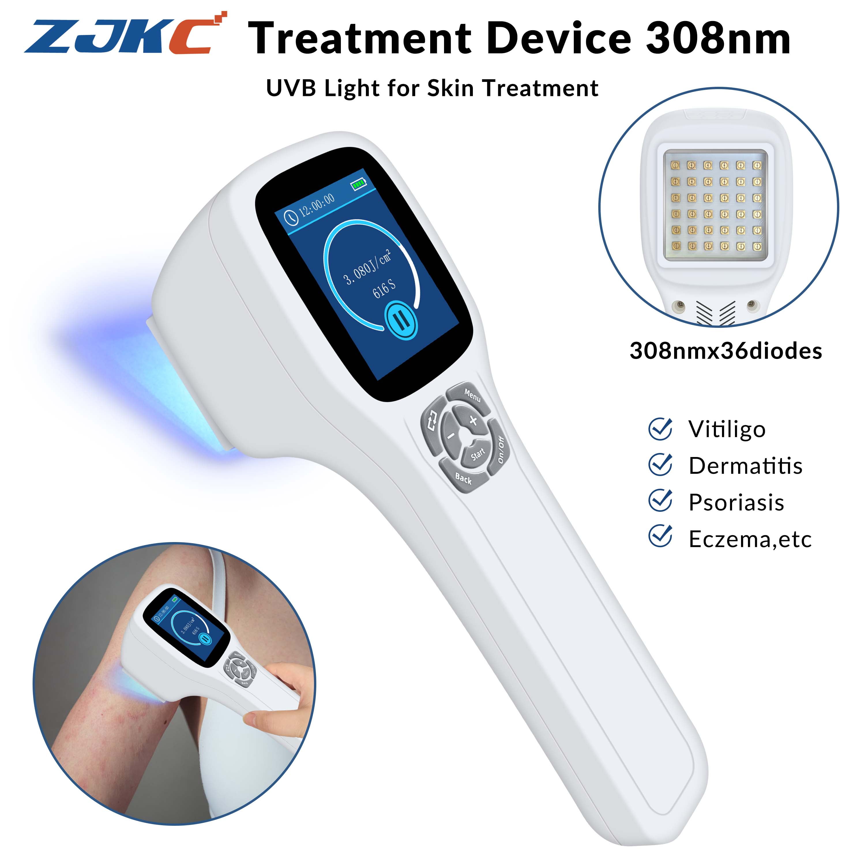 ZJKC 308nm Illuminator with Rechargeable Battery to Relieve Skin Problems - Walmart.com