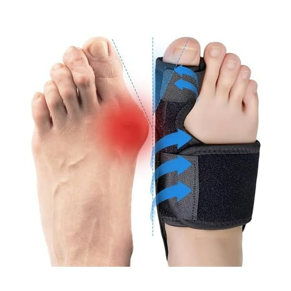 ZLC2-Pack Comfortable Bunion Corrector for Men and Women, Day & Night ...