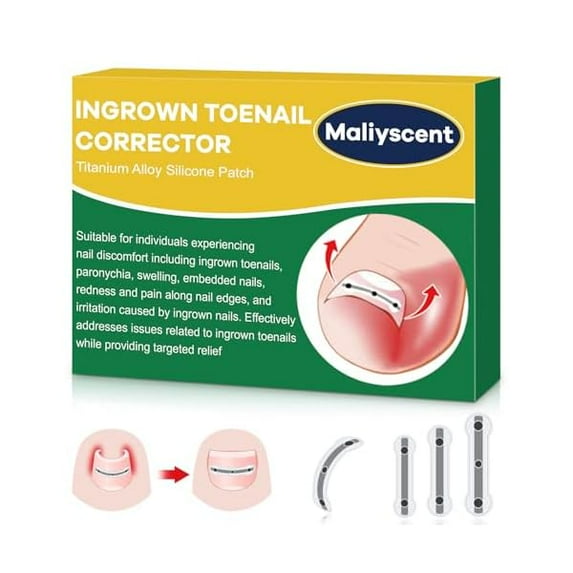 ZLCTitanium Alloy Ingrown Toenail Corrector New Version Ingrown Toenail ...