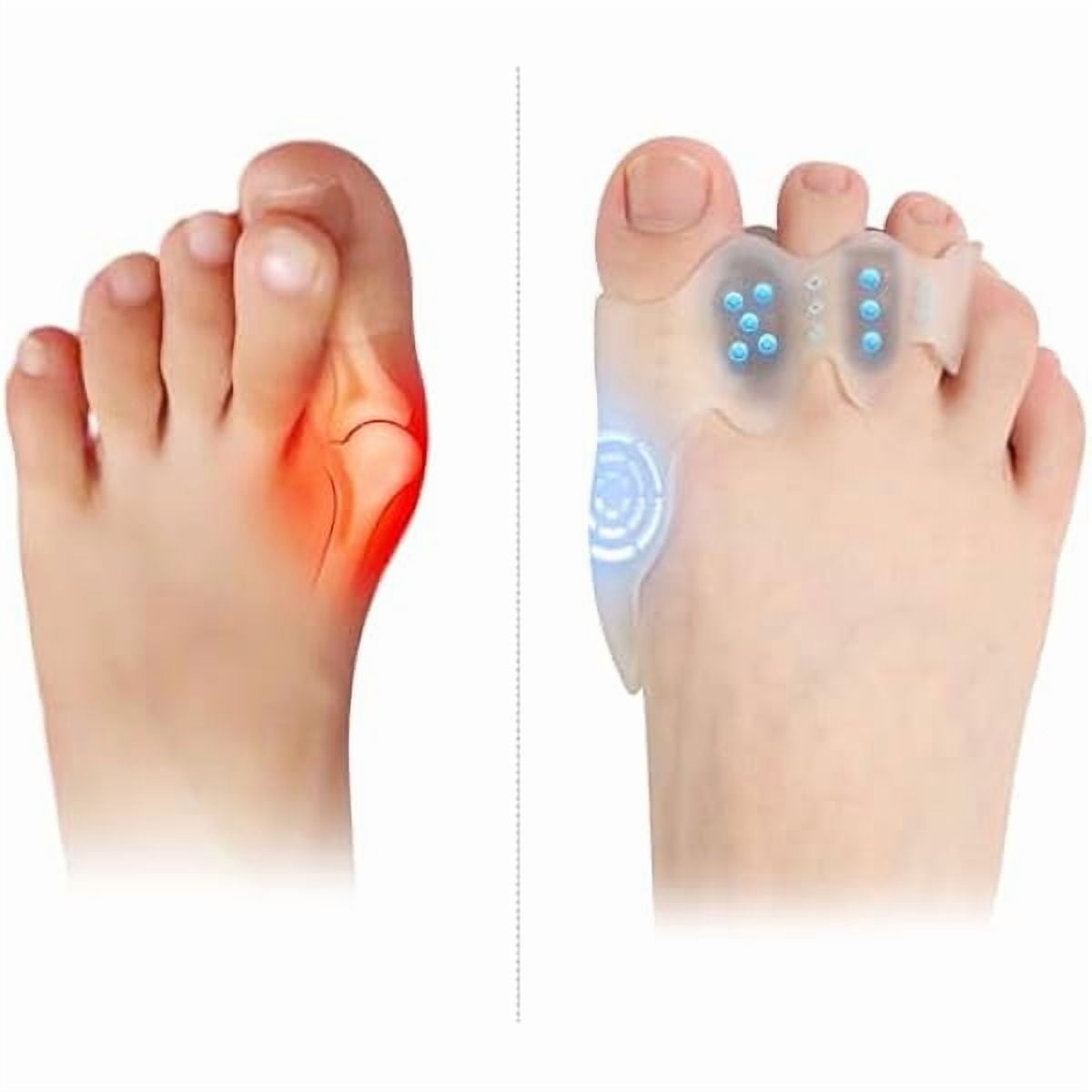 ZLCToe Spacers & Bunion Corrector for Men&Women|Toe Separators,Corn ...