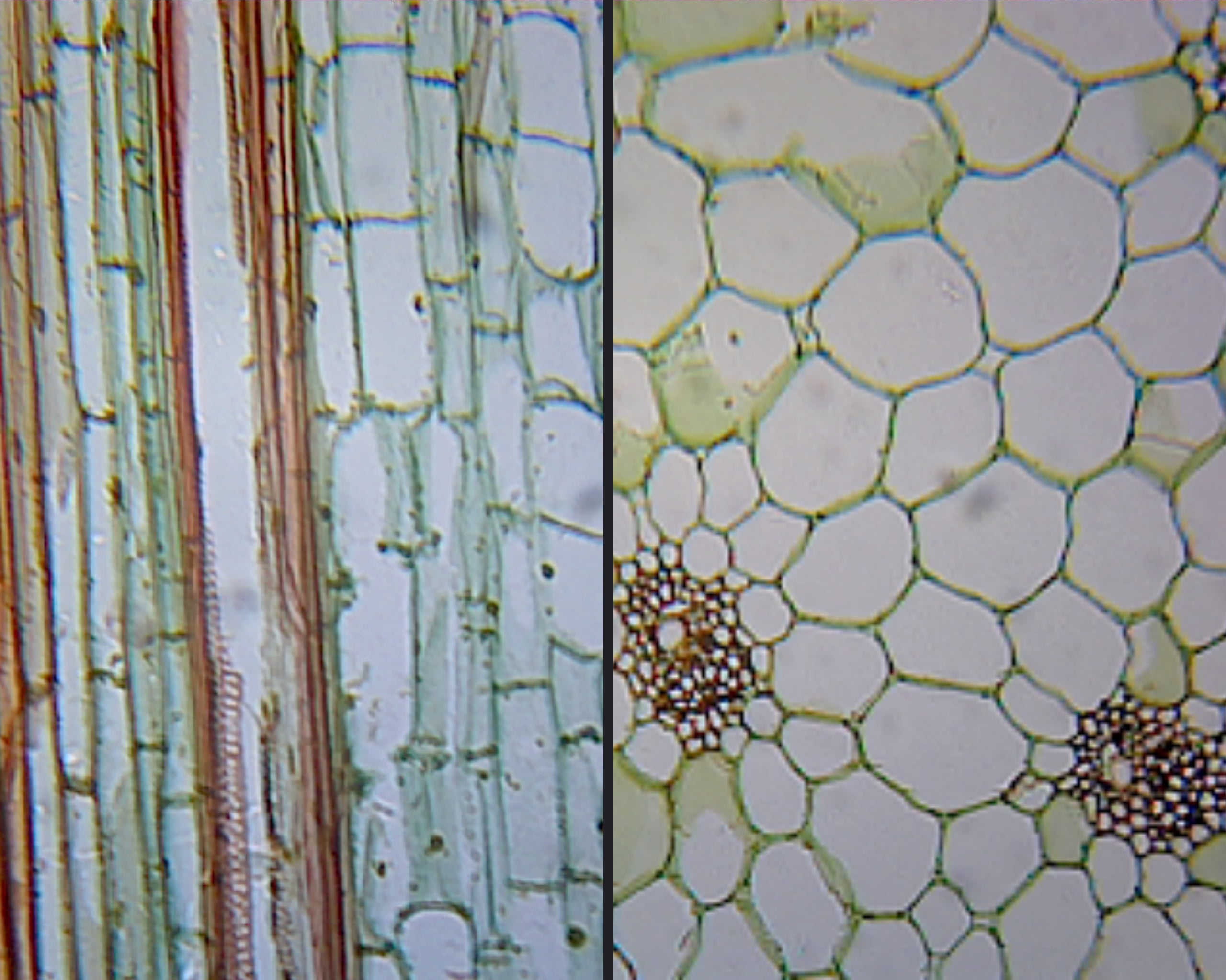 Microscope Slide of Zea Mays (Corn) Stem; Cross Section & Longitudinal ...