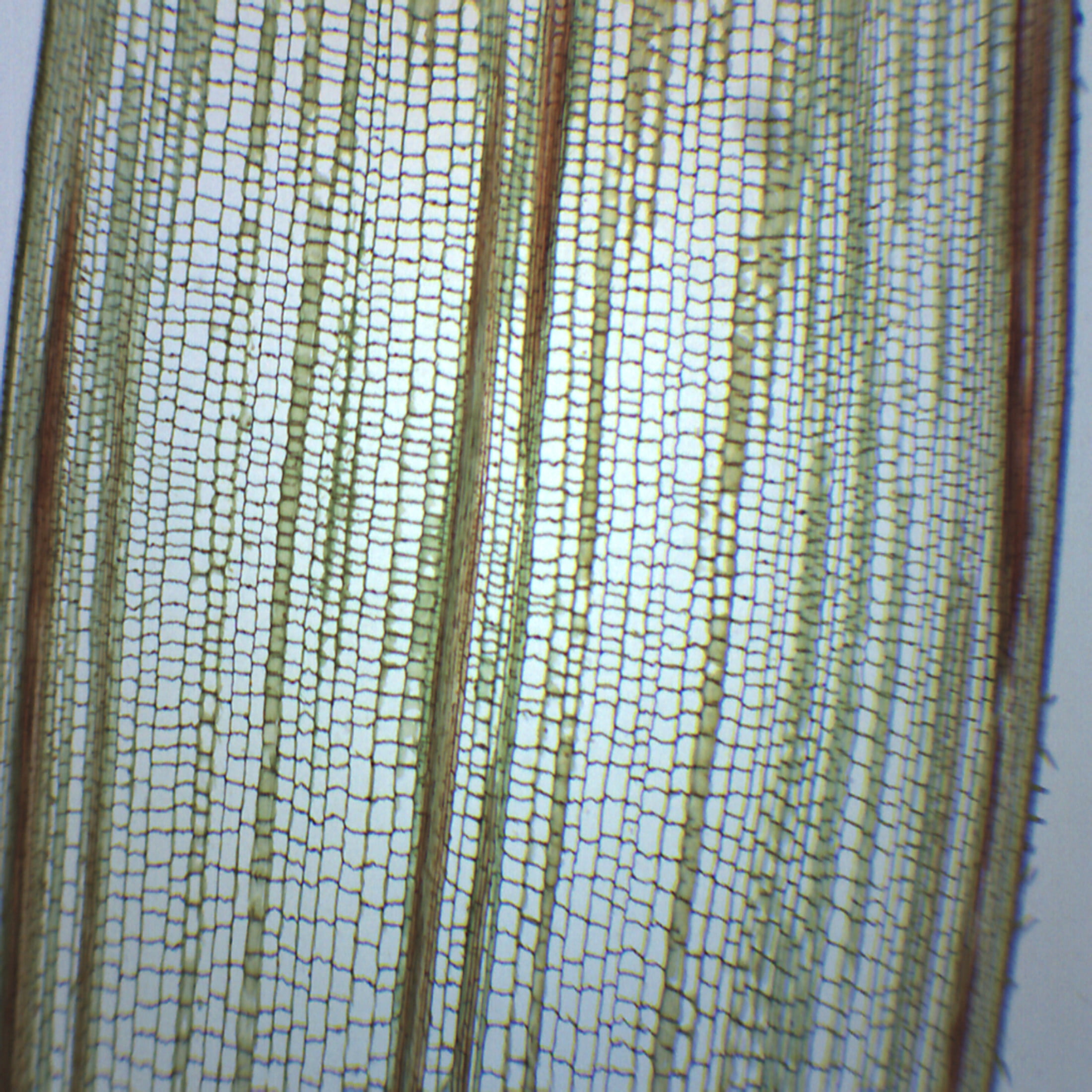 Zea Mays Stem - Cross & Longitudinal Section - Prepared Microscope ...