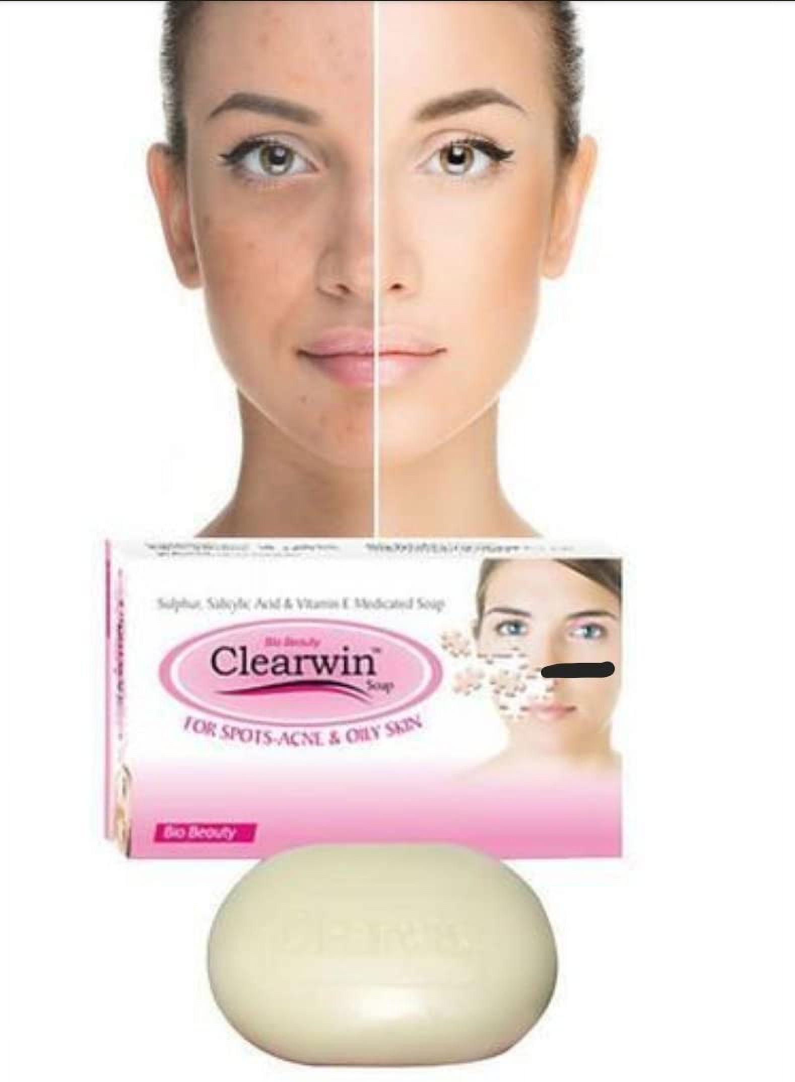 Zee Drugs Clearwin Soap (Pack Of 3) - For Acne And Spots - Walmart.com