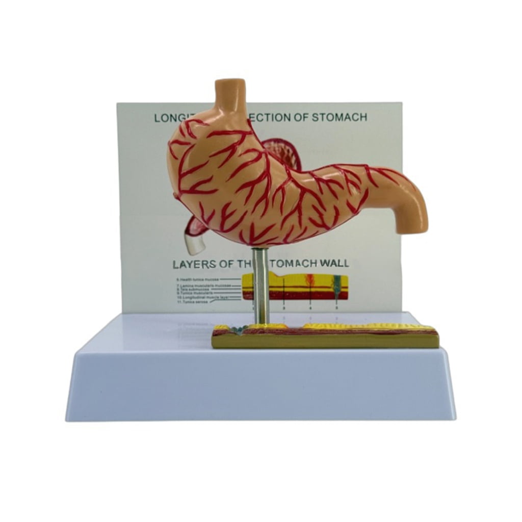 Zeiwohndc Anatomical Gastric Perforation Model Human Pathological ...