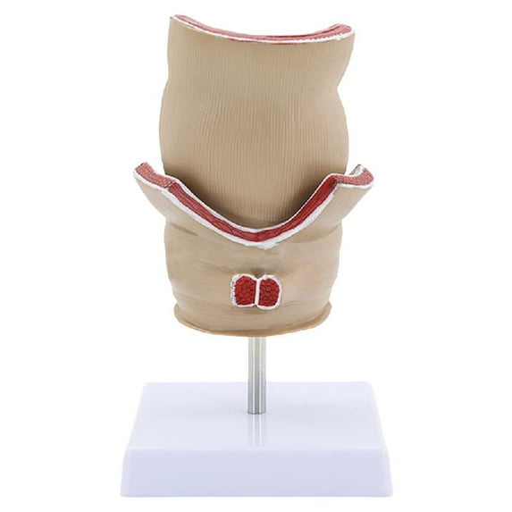 Zeiwohndc Human Pathologies of Rectum Model Medicals Teaching Tool ...